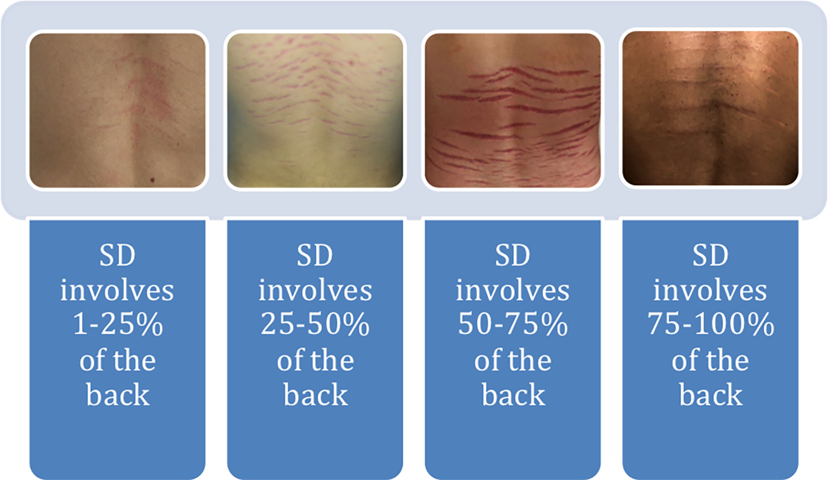 No credible evidence supports rumors about stretch marks