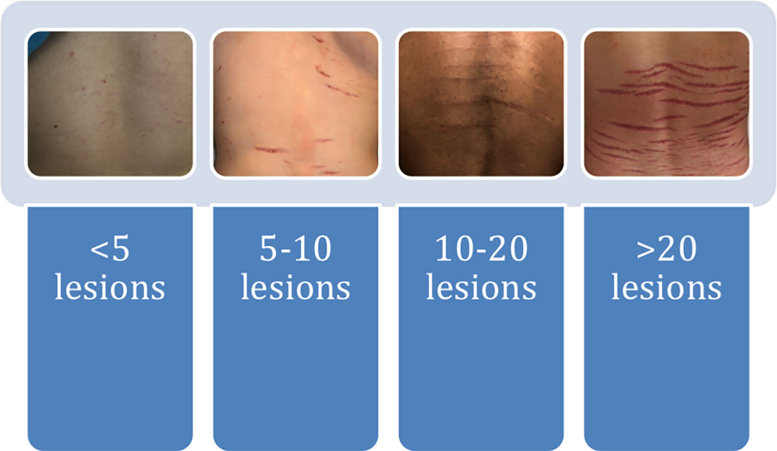 No credible evidence supports rumors about stretch marks