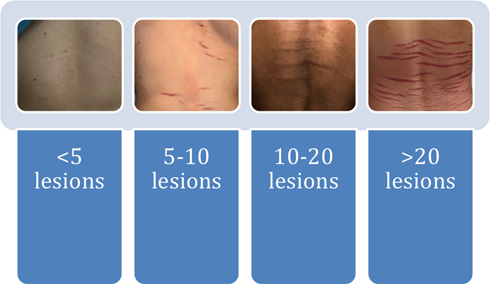 No credible evidence supports rumors about stretch marks